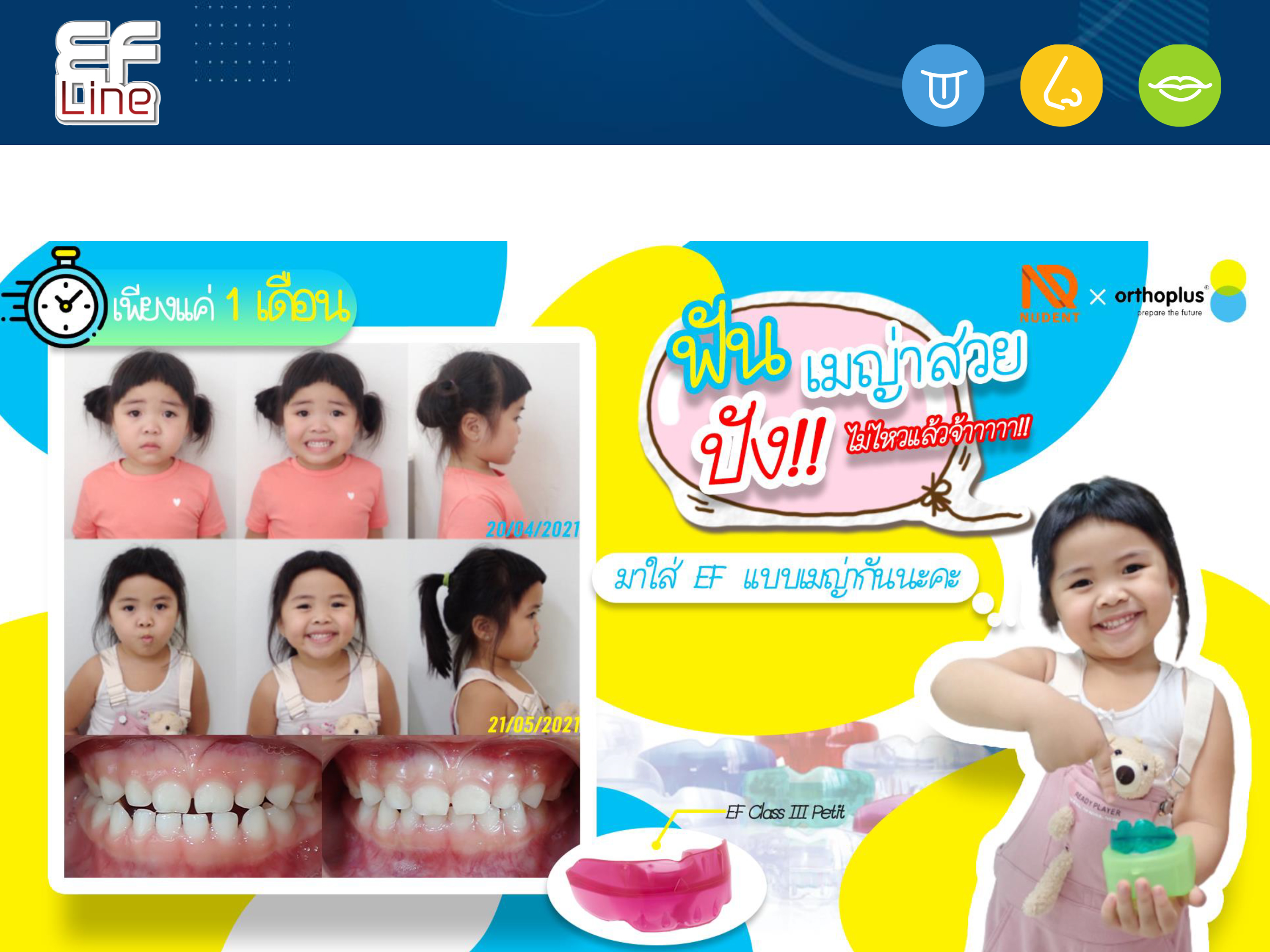 บริการและโปรโมชั่น – คลินิกรักยิ้มทันตกรรม